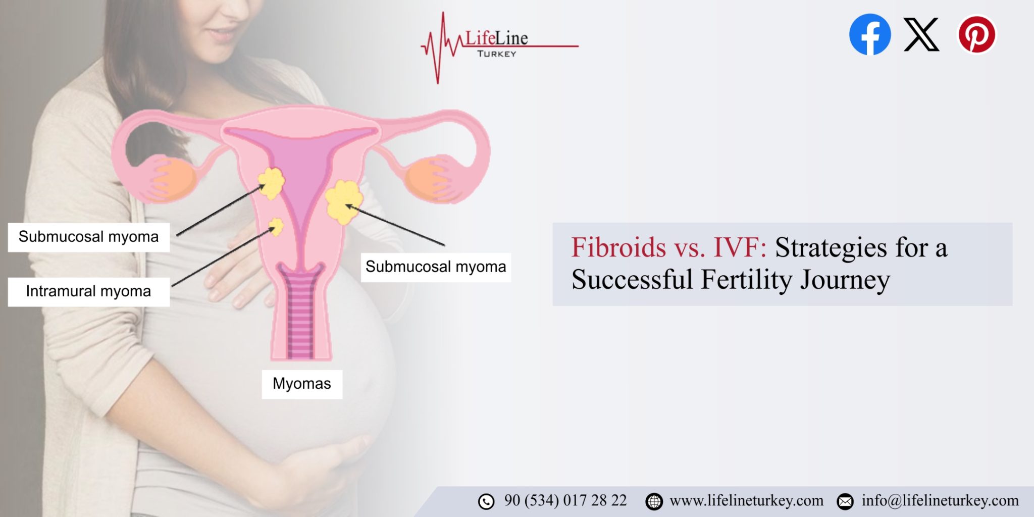 Fibroids vs. IVF: Strategies for a Successful Fertility Journey